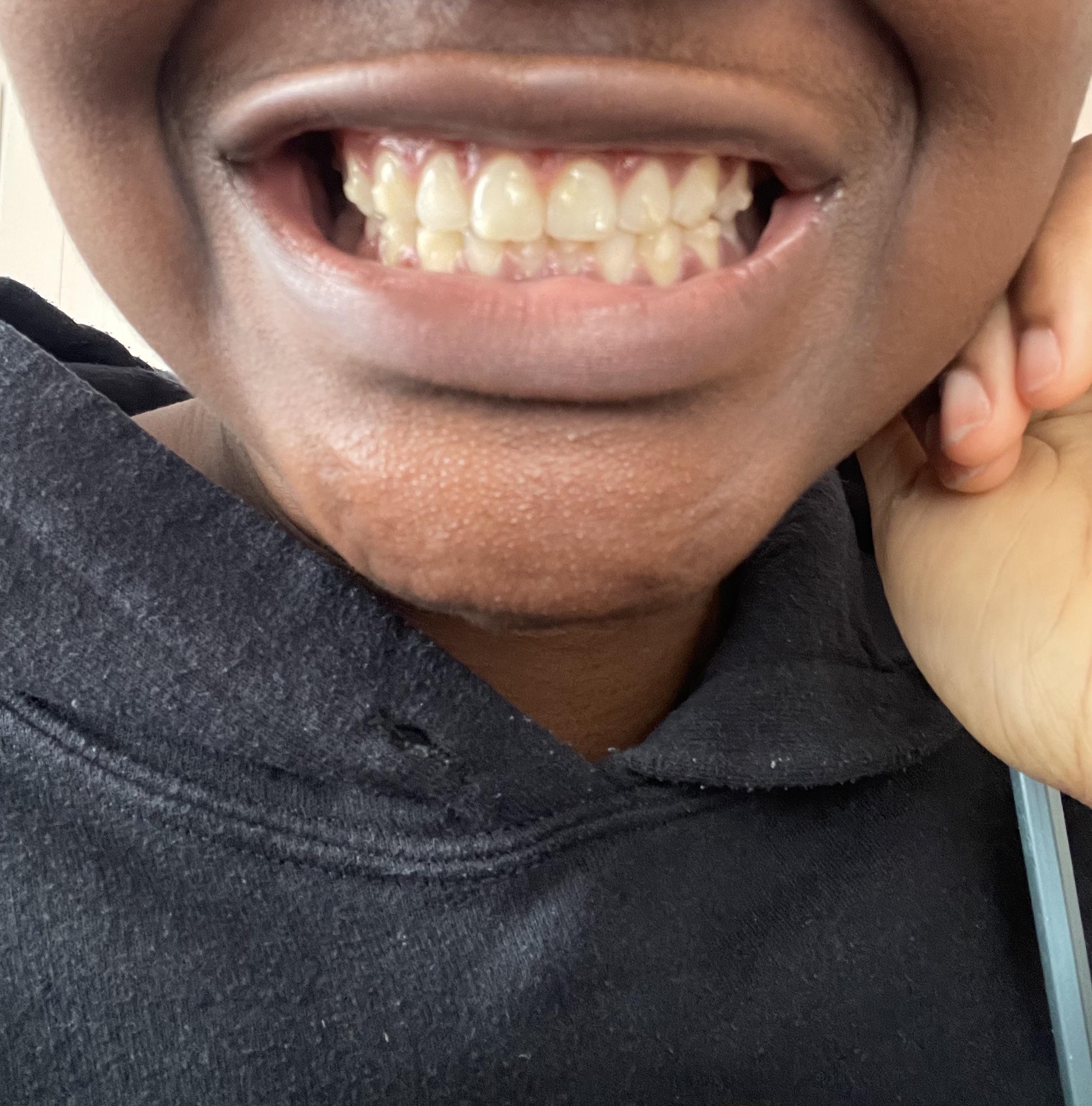 Opinion on final results | Scrolller